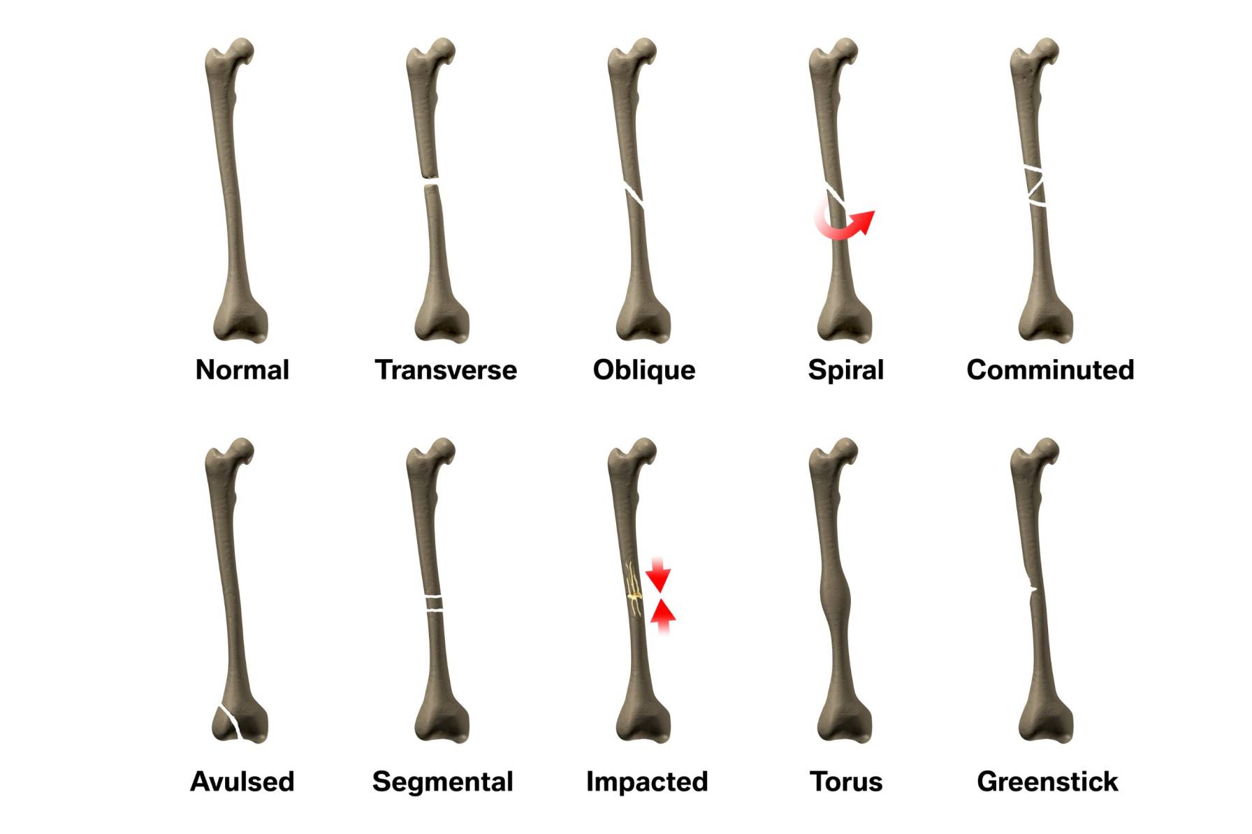 Injuries And Trauma - Midwives Revision