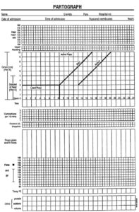 PARTOGRAPH - Midwives Revision
