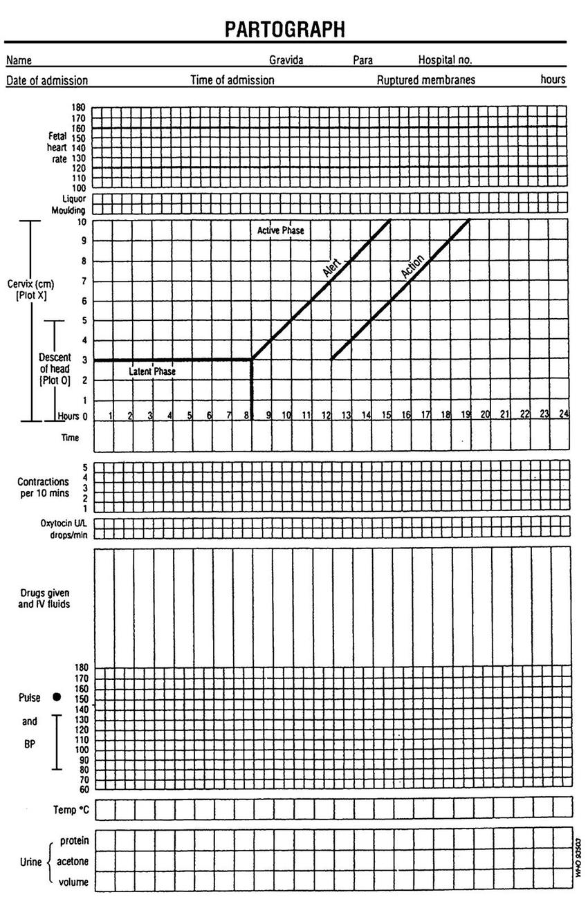 PARTOGRAPH - Midwives Revision