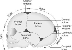FETAL SKULL - Midwives Revision