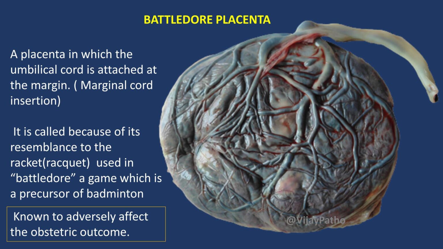 Placenta at Term - Midwives Revision