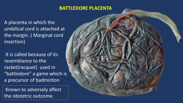 Placenta at Term - Midwives Revision
