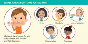 Mumps (Parotitis) - Midwives Revision