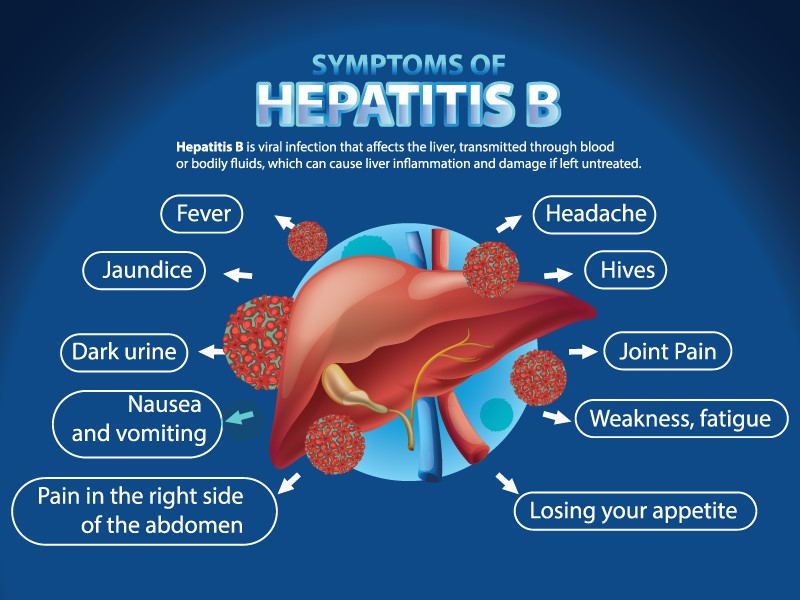Hepatitis B Midwives Revision